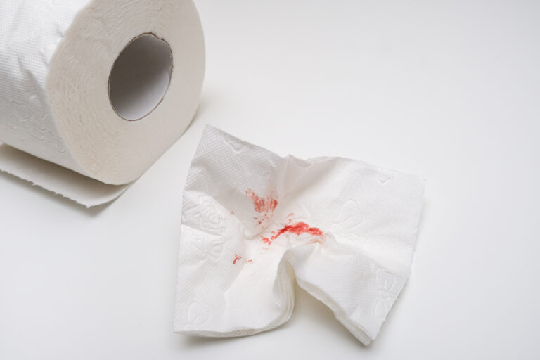 Bleeding from the rectum: What do you need to know? - The Surgeon